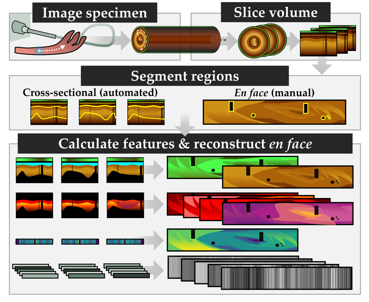 Multimodal Optical Imaging of Ex Vivo Fallopian Tubes to Distinguish ...