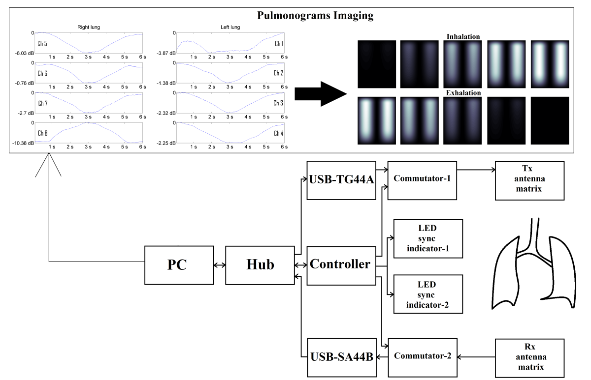 Electromagnetic Imaging for Breathing Monitoring[v1] | Preprints.org